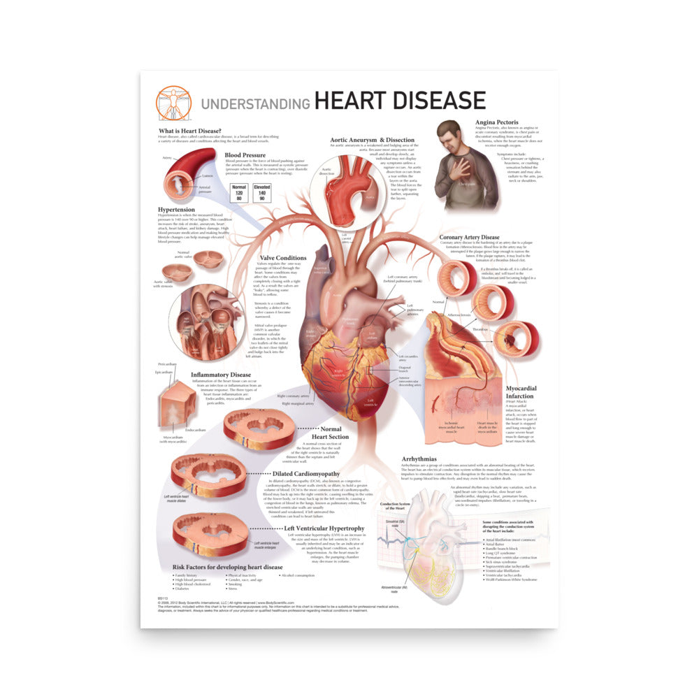 Understanding Heart Disease – Body Scientific