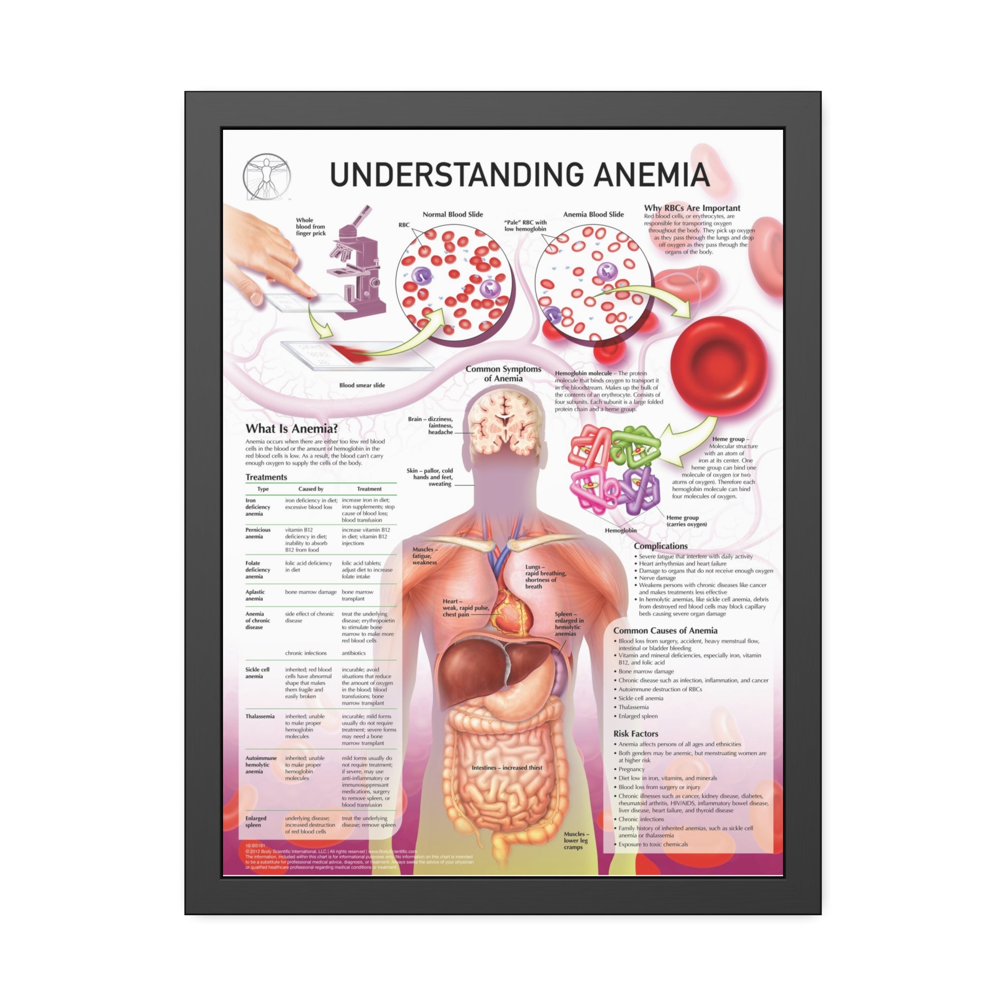Understanding Anemia – Body Scientific
